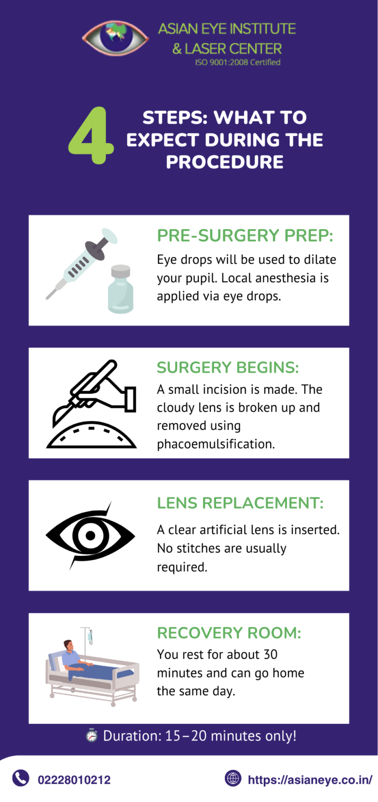 Is Cataract Surgery Safe and Painless? Everything You Need to Know ...
